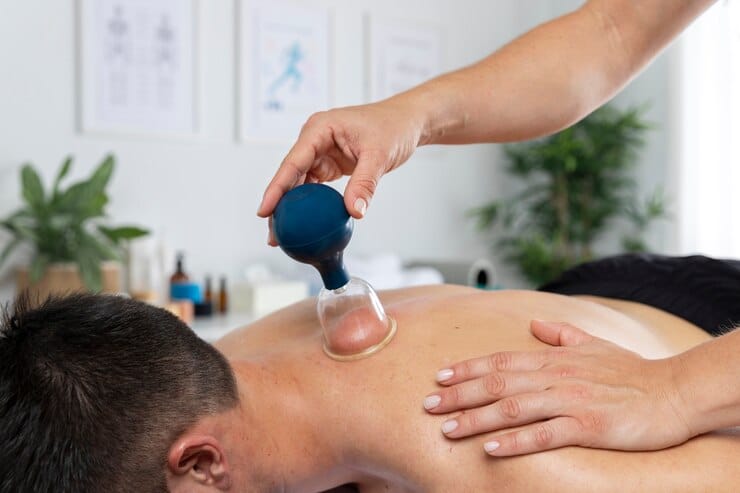 MANUAL CUPPING - AIM Physiotherapy